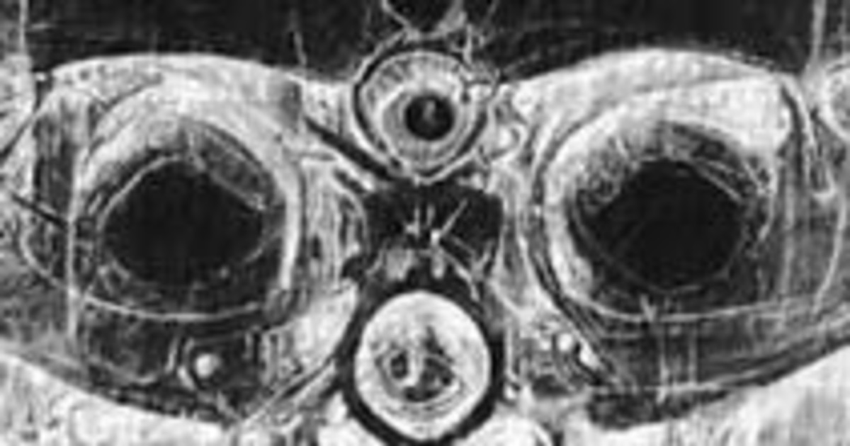 The Solar Return in Chicago at VENUE TBA