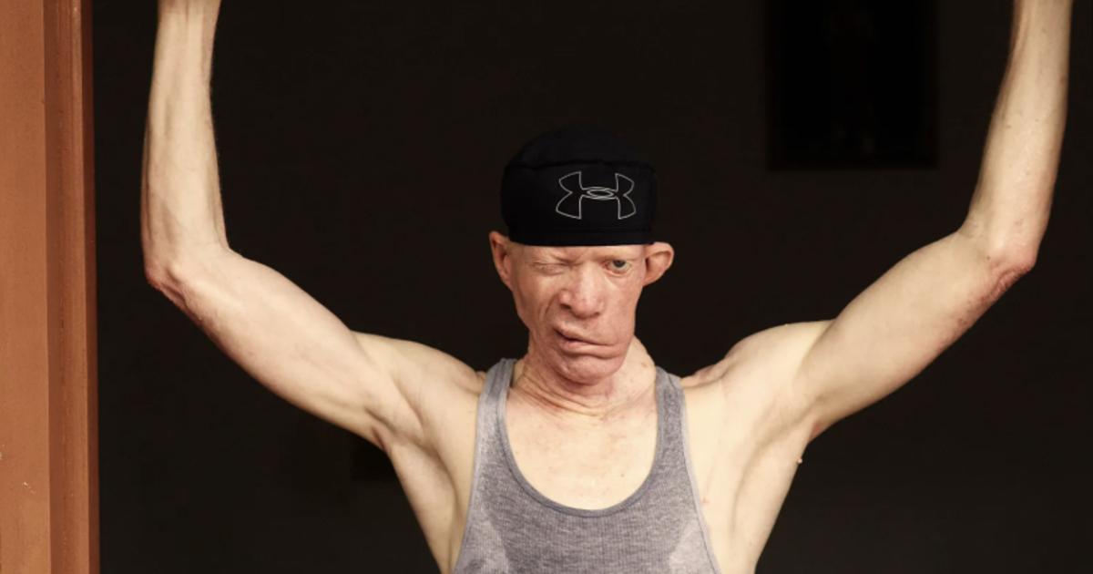 Yellowman in VENICE at The Venice West
